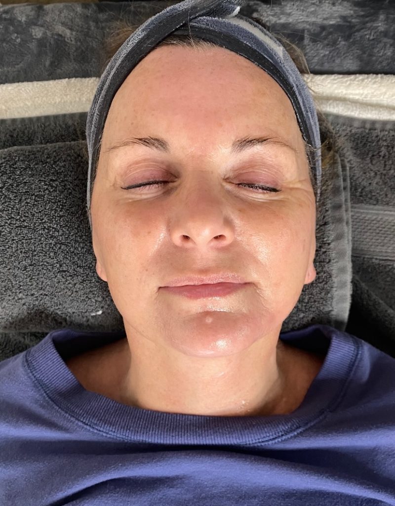 Cryo Offers Effective Nonsurgical Face & Body “Lift” Options